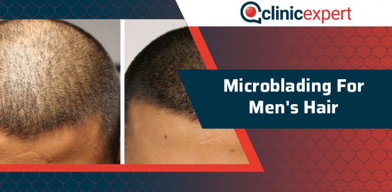 Microblading For Men's Hair | ClinicExpert
