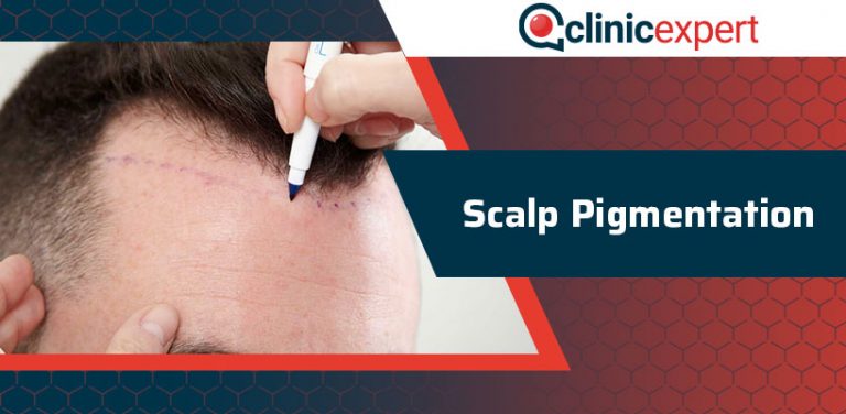 Scalp Pigmentation | ClinicExpert