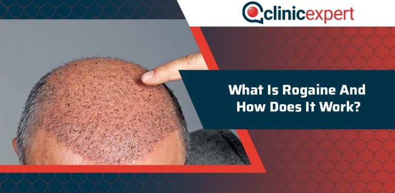 What Is Rogaine And How Does It Work? | ClinicExpert